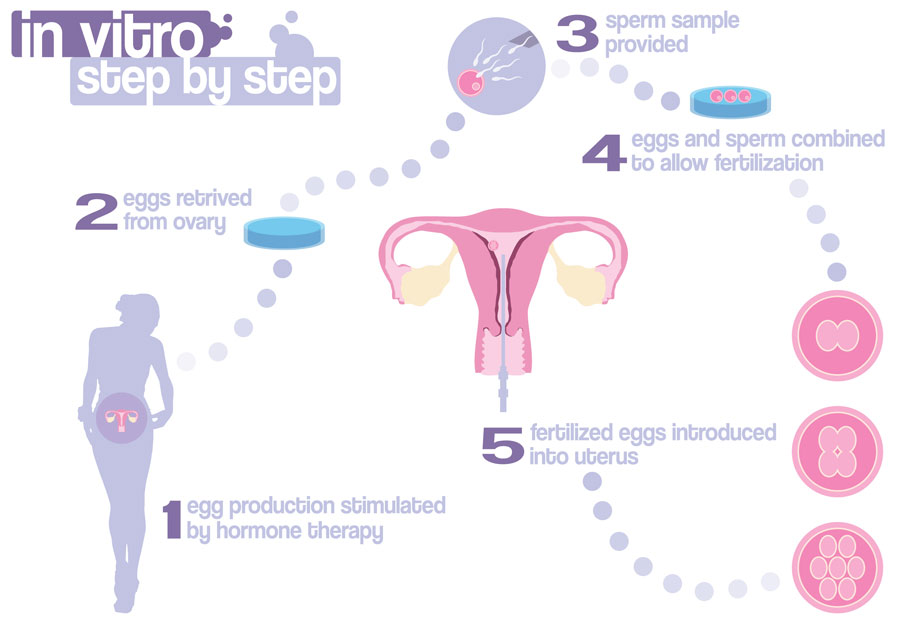 Ivf And Fertility Treatments Fertility And Ivf Coastal Ivf Sunshine Coast